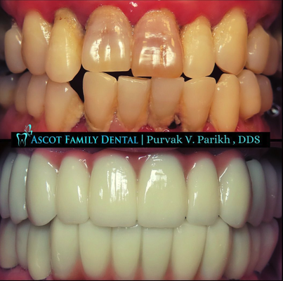 ASCOT FAMILY DENTAL - Updated December 2025 - 309 Photos & 146 Reviews ...