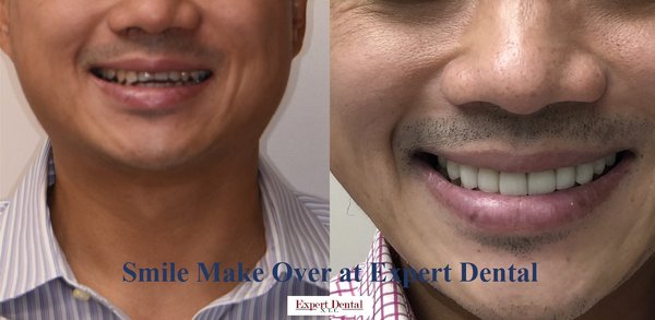 EXPERT DENTAL - Updated December 2025 - 47 Photos & 68 Reviews - 43 ...