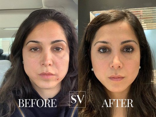 SKIN VITALITY MEDICAL CLINIC TORONTO - Updated February 2026 - 121 ...