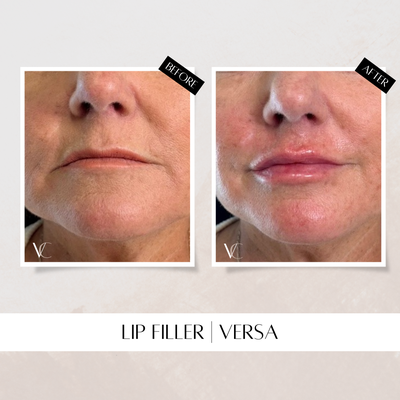 VANITY COMPOUND MEDICAL AESTHETICS - Updated December 2025 - 112 Photos & 38 Reviews - 16400 ...