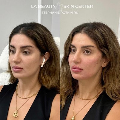 LA BEAUTY SKIN CENTER - 656 Photos & 2138 Reviews - 1330 S Glendale Ave ...