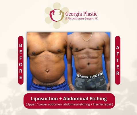 GEORGIA PLASTIC & RECONSTRUCTIVE SURGERY - Updated May 2026 - 93 Photos ...