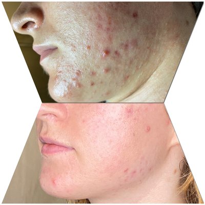 AUBRIE COOK AESTHETICS - Updated October 2025 - 75 Photos & 52 Reviews ...