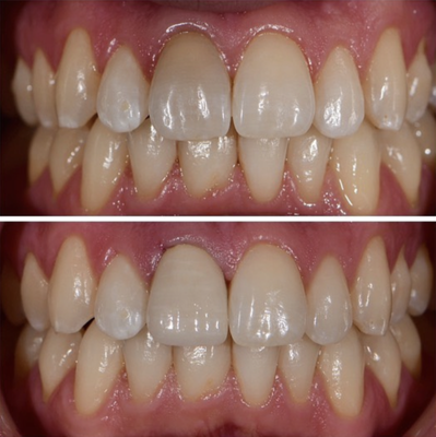 FULLER SMILES - LONG BEACH - Updated December 2025 - 51 Photos & 119 ...