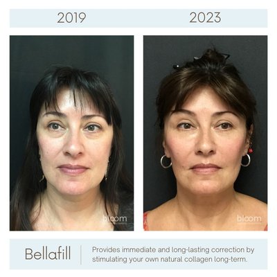 BLOOM - ADVANCED MED SPA - Updated January 2025 - 13 Photos - 555 Cajon ...