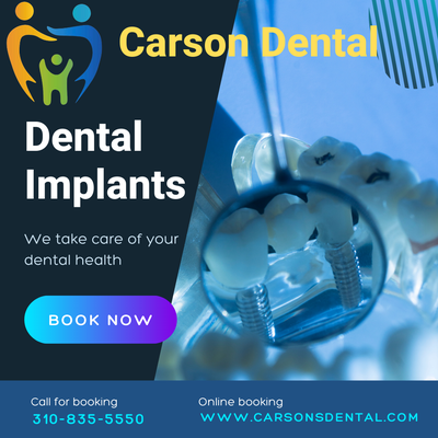 CARSON DENTAL - Updated December 2025 - 125 Photos & 197 Reviews ...