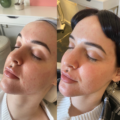 OASIS FACE BAR NASHVILLE - Updated April 2025 - 31 Photos - 1200 Villa ...