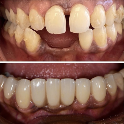 FULLER SMILES - LONG BEACH - Updated December 2025 - 51 Photos & 119 ...