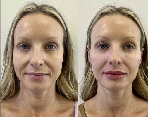 SKINFINITY MEDSPA - Updated December 2025 - 43 Photos & 36 Reviews ...