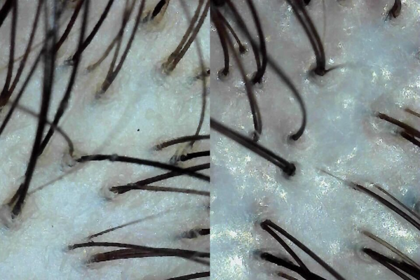 ELYSIAN HEAD SPA - Updated January 2026 - 65 Photos & 21 Reviews - 1201 ...