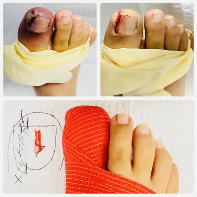 SUNSET FOOT CLINIC - THOMAS D LIM, DPM | LOS ANGELES - Updated January ...