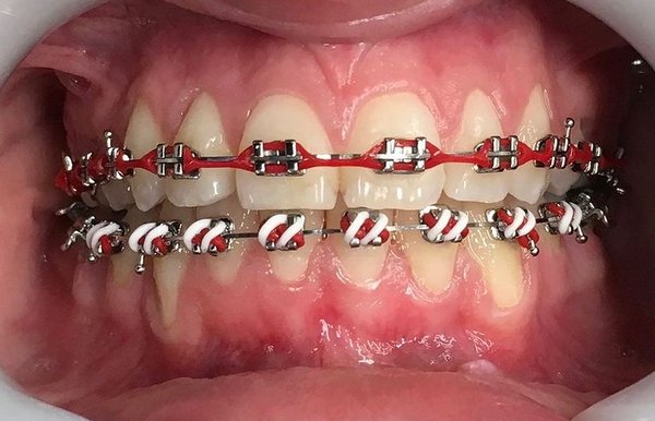 MATTHEW RONCONI ORTHODONTICS - Updated March 2025 - 29 Photos & 19 ...