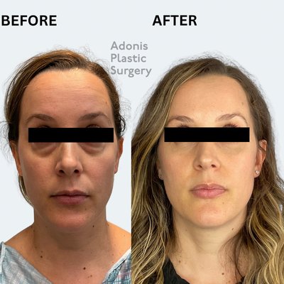 ADONIS PLASTIC SURGERY - Updated October 2025 - 59 Photos - 29 Reviews - 2557 Pacific Coast Hwy ...