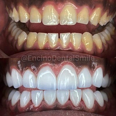 ENCINO DENTAL SMILE - Updated December 2025 - 411 Photos & 148 Reviews ...
