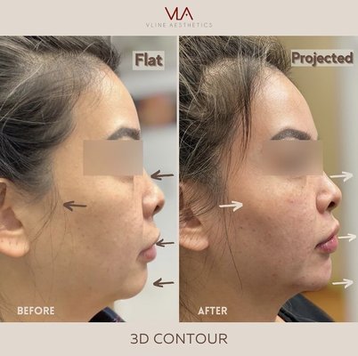 SKIN PERFECT BROTHERS - Updated December 2025 - 794 Photos & 588 ...