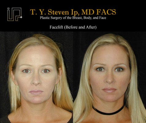 T.Y. STEVEN IP, MD - Updated December 2025 - 380 Photos & 144 Reviews ...