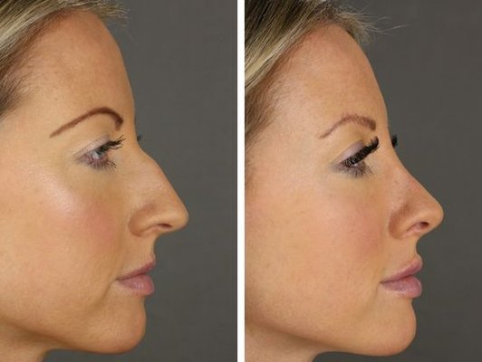 DAVID A NEWMAN, MD FACS - NEWMAN TEMECULA PLASTIC SURGERY - Updated ...