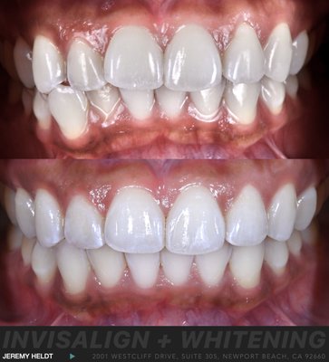 JEREMY HELDT, DDS - 228 Photos & 91 Reviews - 2001 Westcliff Dr ...