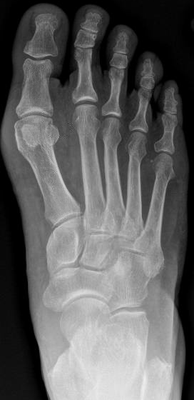 CASCADE FOOT CENTER - Updated October 2024 - 3474 Liberty Rd S, Salem ...