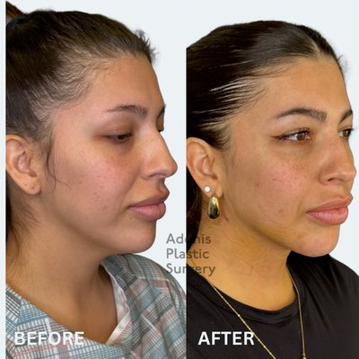 ADONIS PLASTIC SURGERY - Updated October 2025 - 59 Photos - 29 Reviews - 2557 Pacific Coast Hwy ...