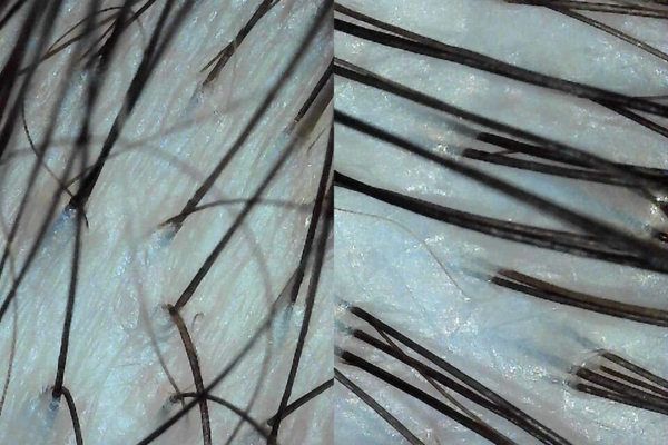 ELYSIAN HEAD SPA - Updated January 2026 - 65 Photos & 21 Reviews - 1201 ...