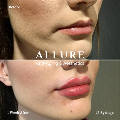 ALLURE ANTI-AGING & AESTHETICS - Updated January 2026 - 96 Photos & 44 ...