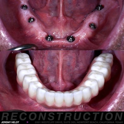 JEREMY HELDT, DDS - Updated December 2025 - 219 Photos & 104 Reviews ...