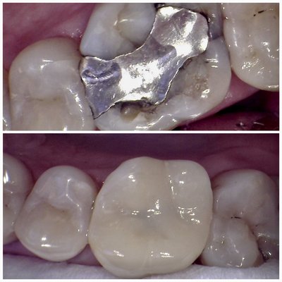 GLEN DENTAL STUDIO: STEPAN HARUTYUNYAN, DMD - Updated December 2025 ...